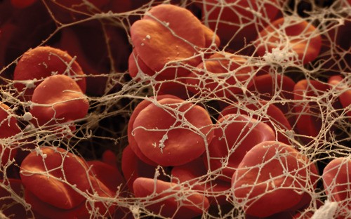 Thrombolytic vs Fibrinolytic vs Anticoagulant agents - Offline Clinic